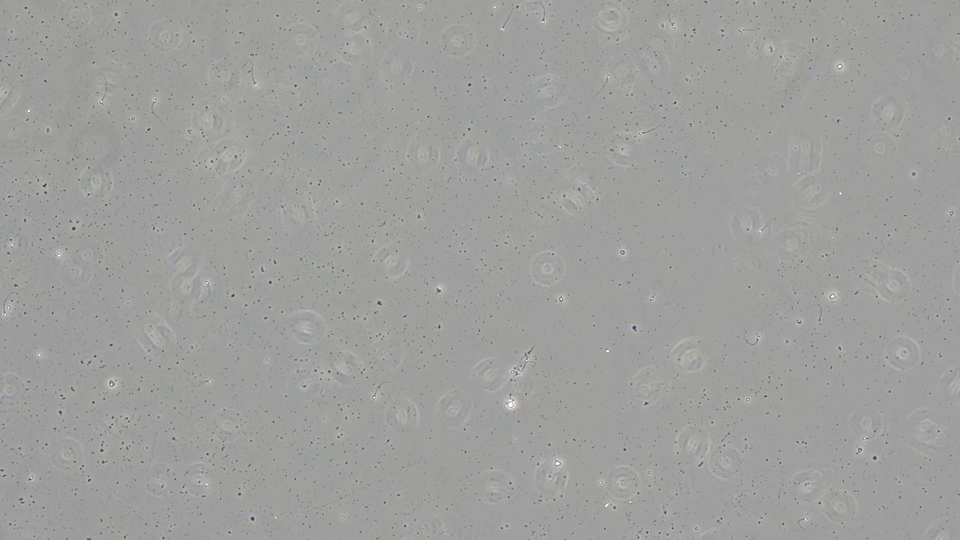 Sperm Detector Object Detection Dataset by 20232024BitirmeProjesi