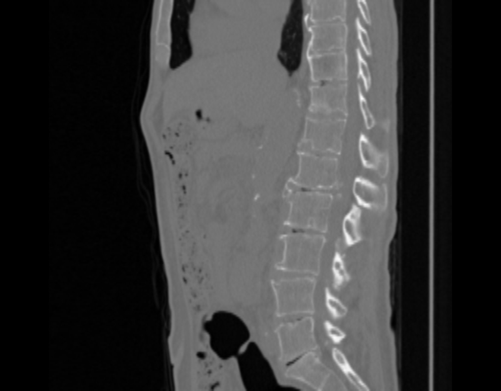OVCF Object Detection Dataset by Wongthawat Liawrungrueang
