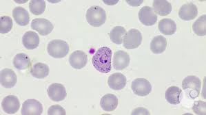 malaria Detection Object Detection Model by pvp polytechnic