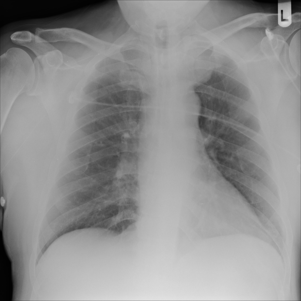 Cardiothoracic Ratio Object Detection Dataset and Pre-Trained Model by ... Cardiothoracic Ratio Object Detection Dataset and Pre-Trained Model by ...