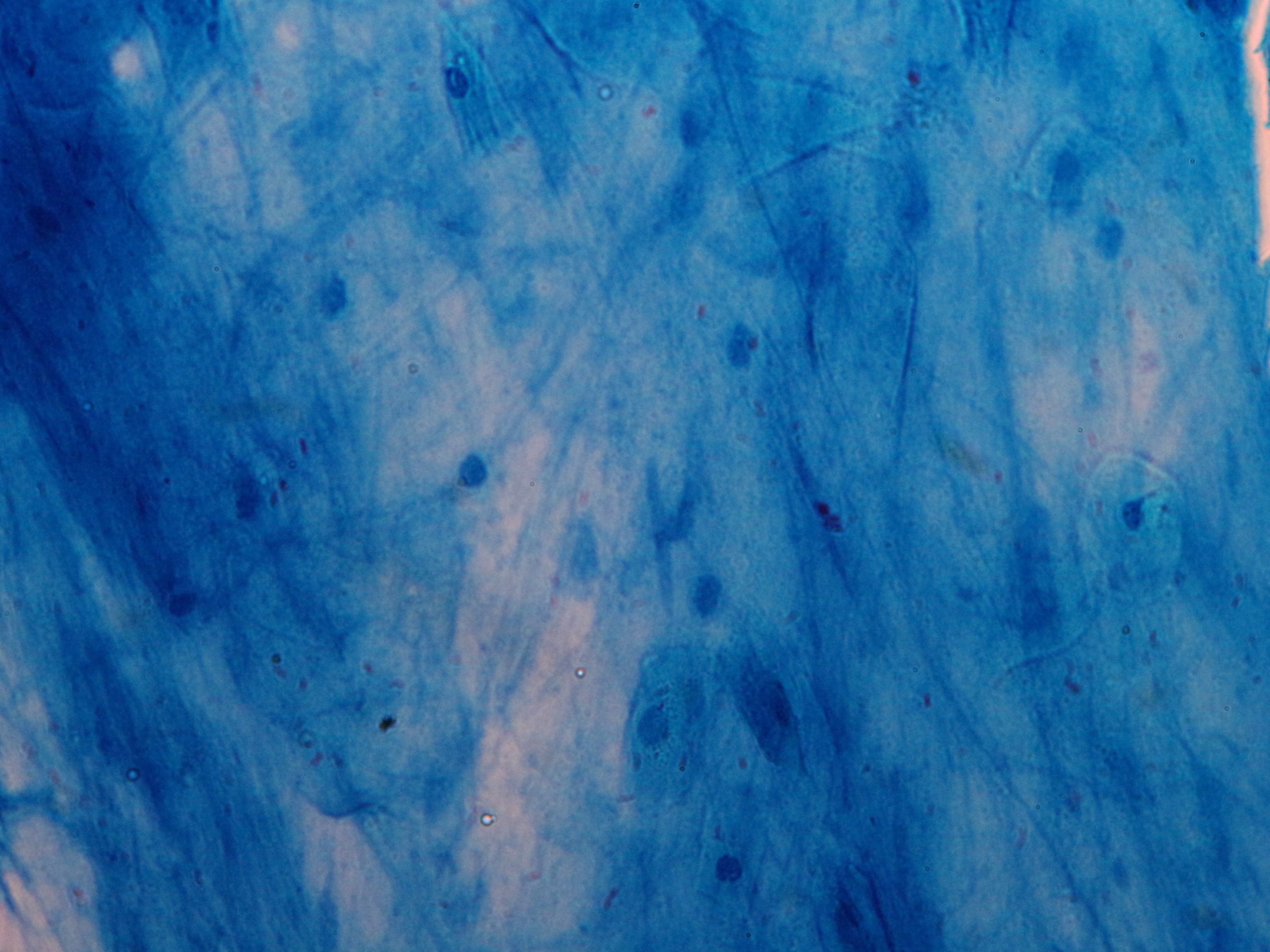 Tuberculosis Classification Object Detection Dataset By Shriyanr