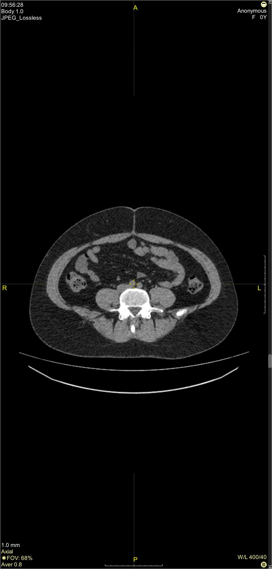 v1 Instance Segmentation Dataset by project-rvruw