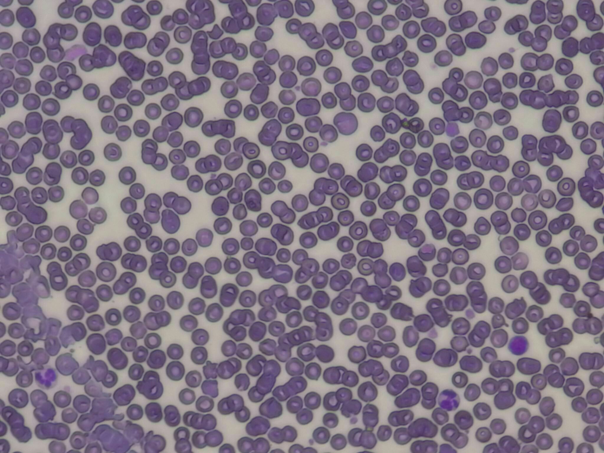 YOLO v11 (Instance segmentation) (increase) (2025.03) Instance ...