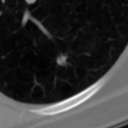 lung_cancer_segmentation Instance Segmentation Dataset by lungcancerteam