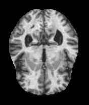 BRAIN MRI Classification Model by opl