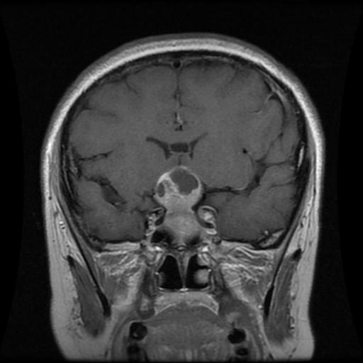 kaggle brain tumor add Object Detection Dataset by brain tumor