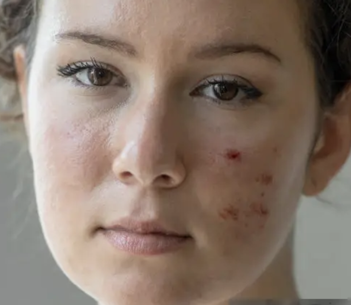 skin Instance Segmentation Dataset by skin