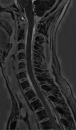 MRI_Seg_Health Object Detection Dataset by MRIImage