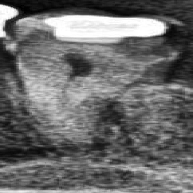Caries Detection New Classification Model By Project Group13