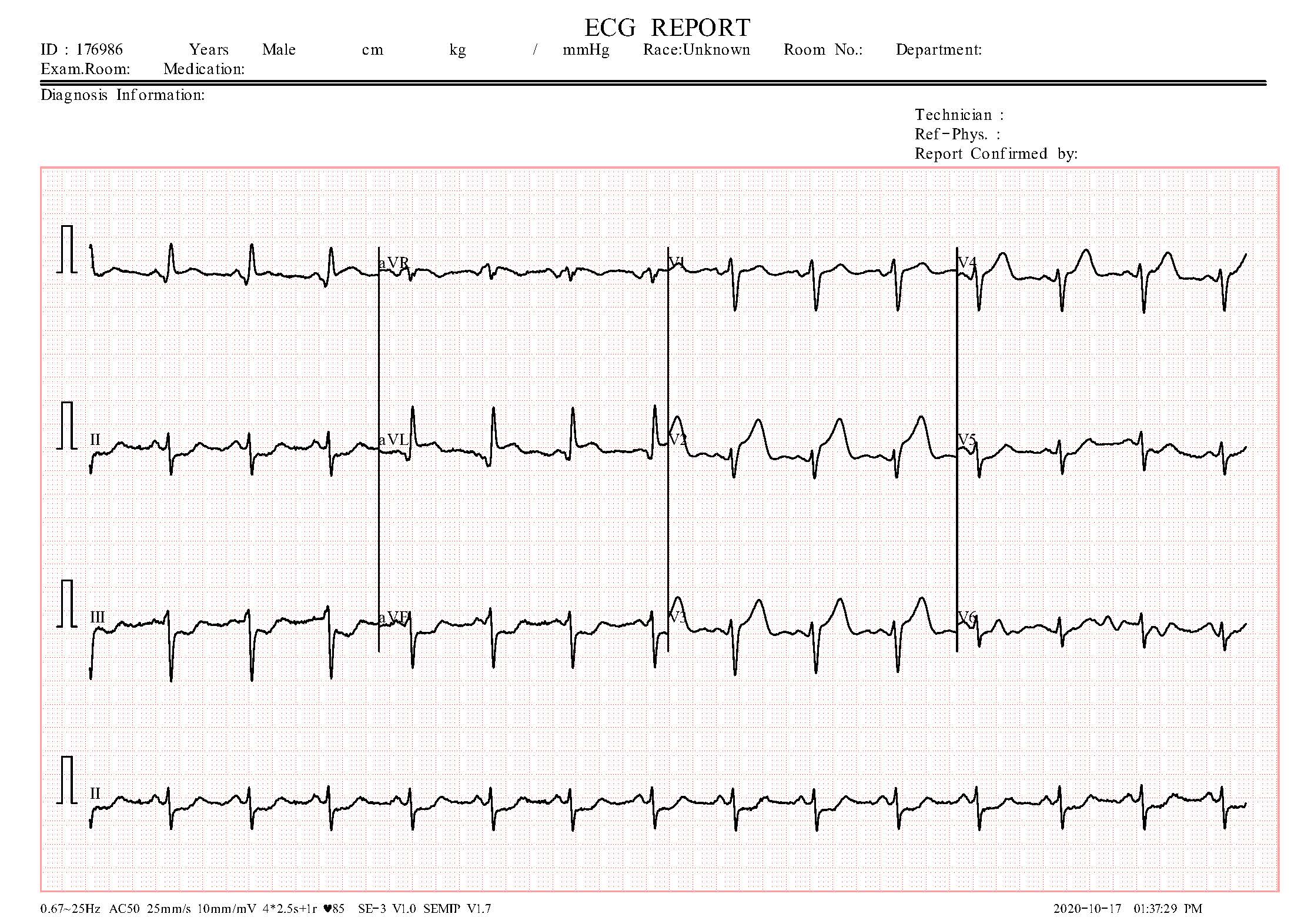 lac2 Object Detection Dataset by LamGiaLac