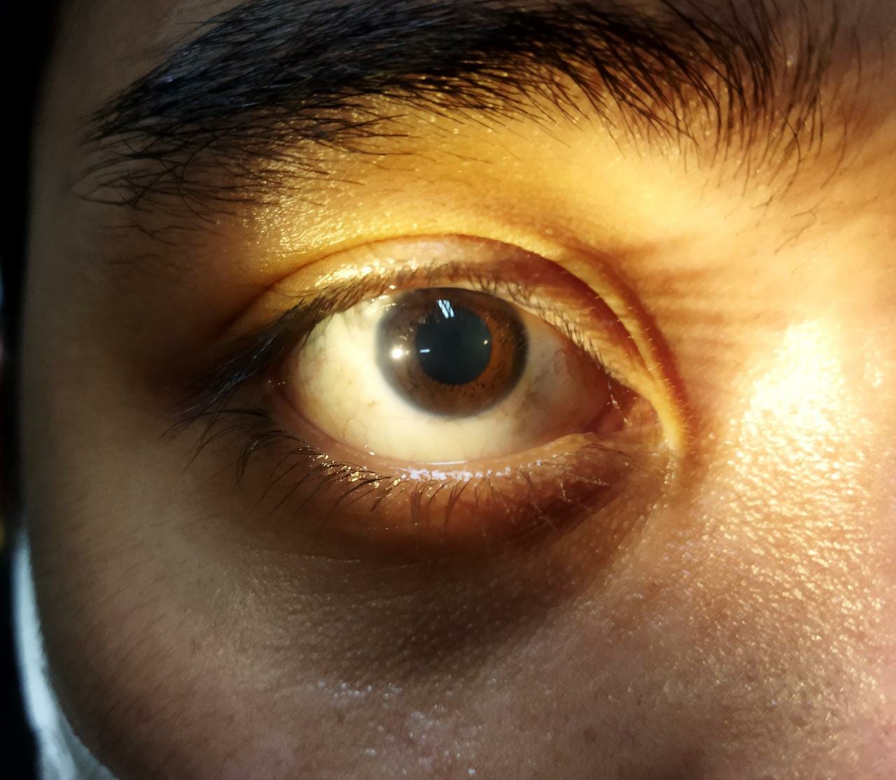 Pupil Segmentation Instance Segmentation Dataset by Nexus