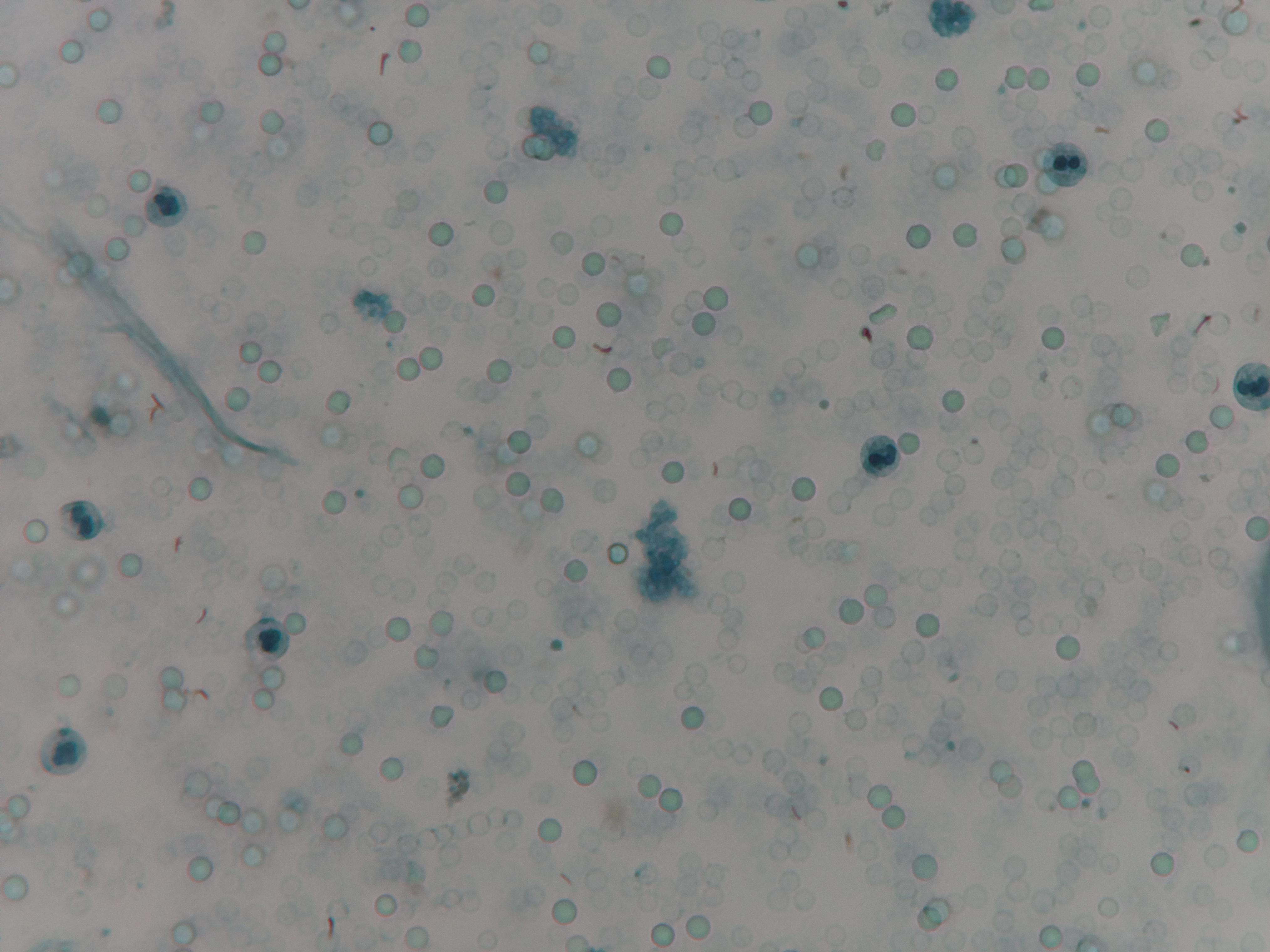 Top Neu Datasets and Models | Roboflow Universe