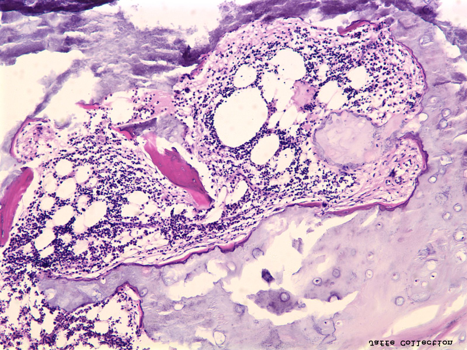 Low Grade Version Classification Dataset and Pre-Trained Model by Jaffe