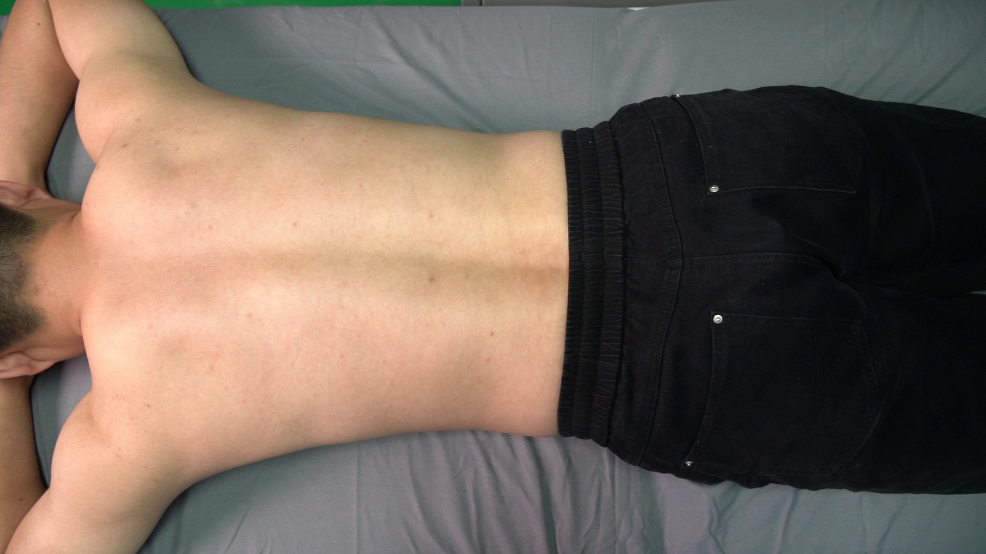 back Instance Segmentation Dataset by project-zulyk