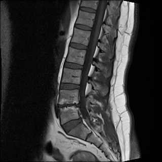 spinal segmentation Instance Segmentation Dataset by SAG
