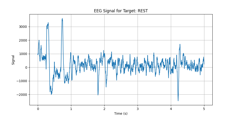 eeg_classification Classification Model by SSEL