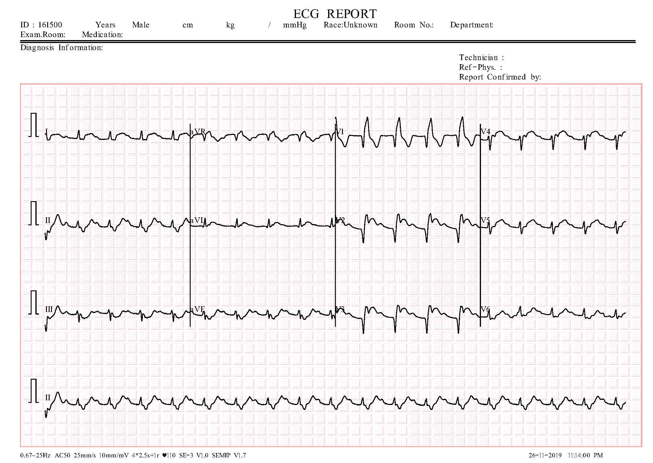 Heart Disease Detection Classification Dataset (v1, 2025-03-29 9:33pm ... Heart Disease Detection Classification Dataset (v1, 2025-03-29 9:33pm ...