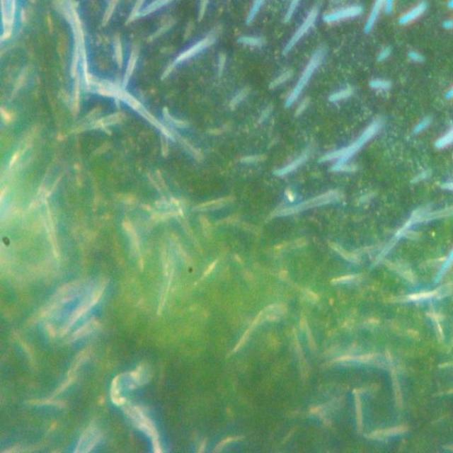 Trichome 2 Object Detection Model By Tribhuvan University