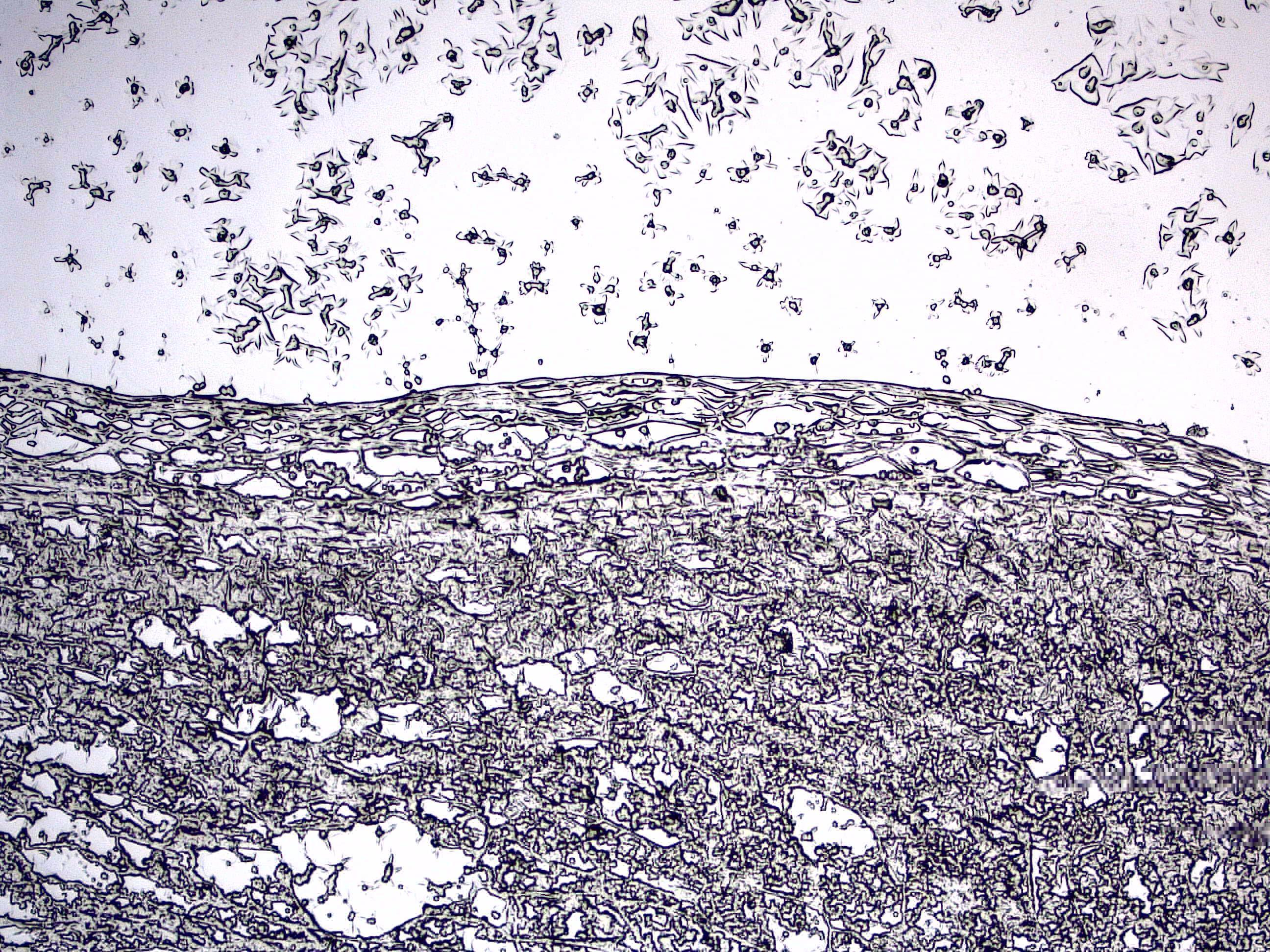 补充玉米 Instance Segmentation Dataset by MyData