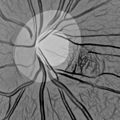Nasalization Instance Segmentation Model by Nasalization