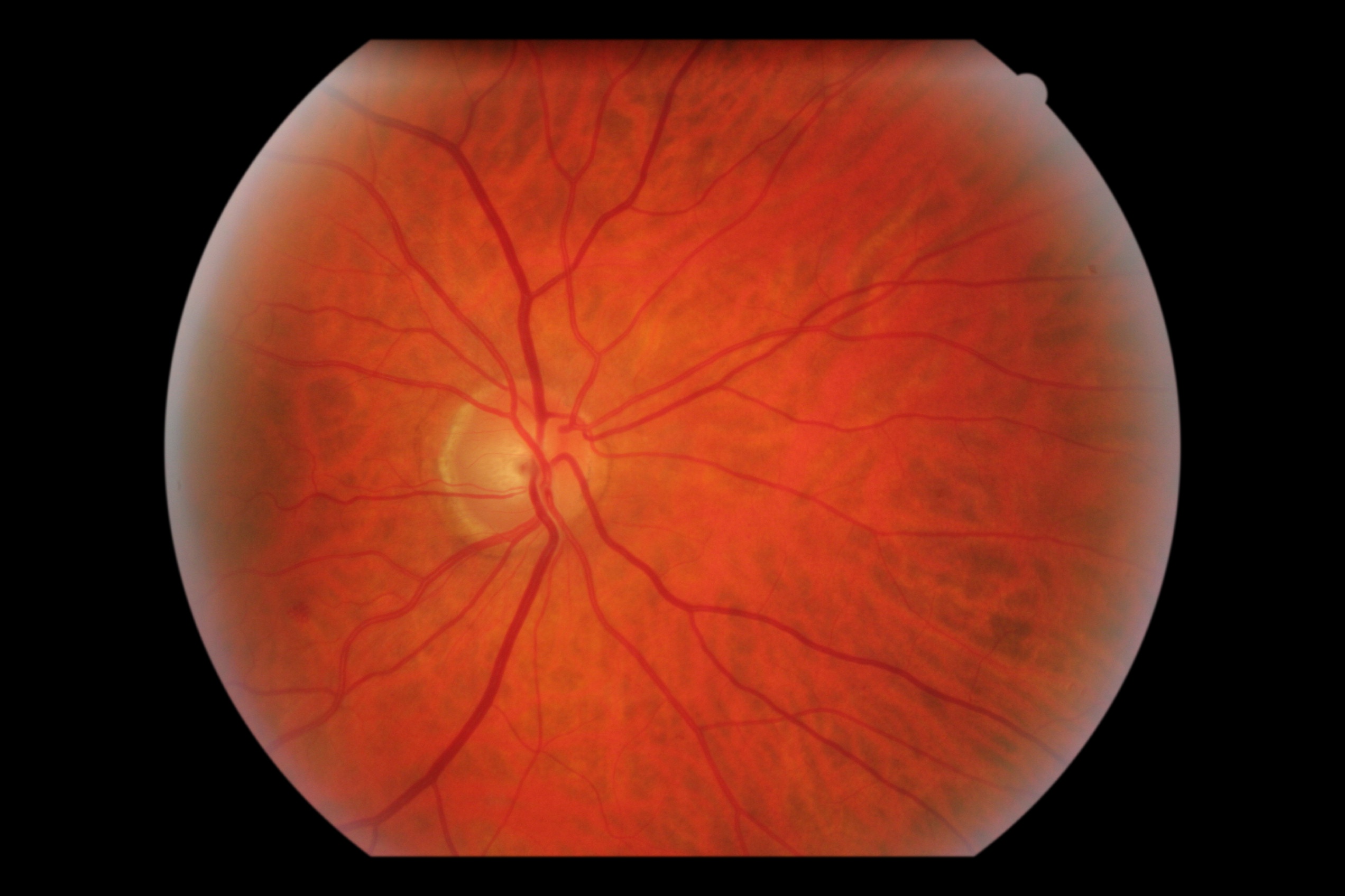 e_ophtha_MA Object Detection Dataset by Tuiuo