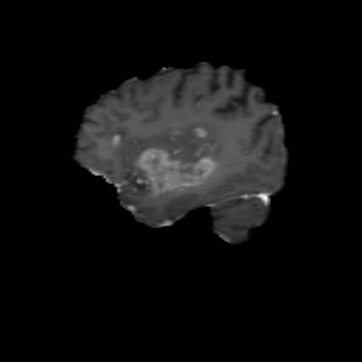 Brain_detect Object Detection Dataset by fasih