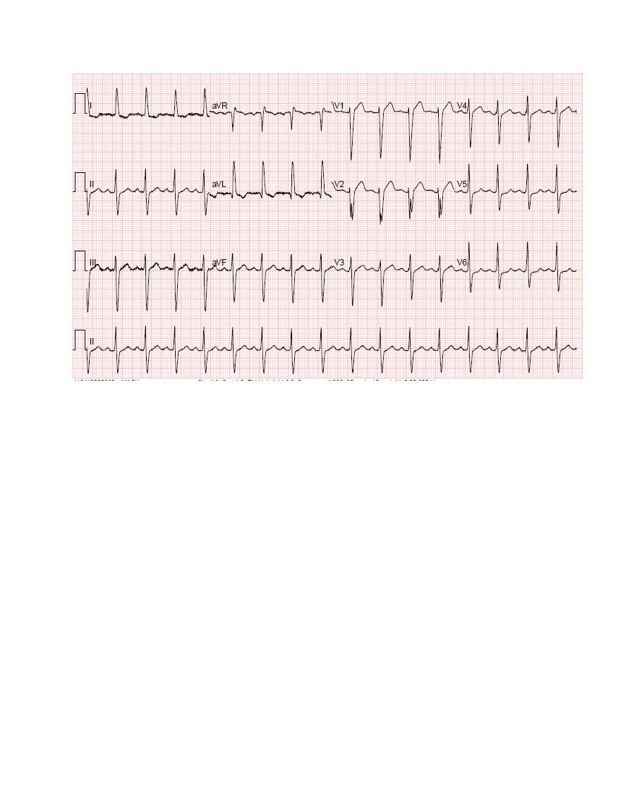 ecg_detected Classification Dataset and Pre-Trained Model by eita ecg_detected Classification Dataset and Pre-Trained Model by eita