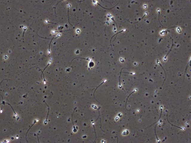 sperm Object Detection Dataset by Project saya