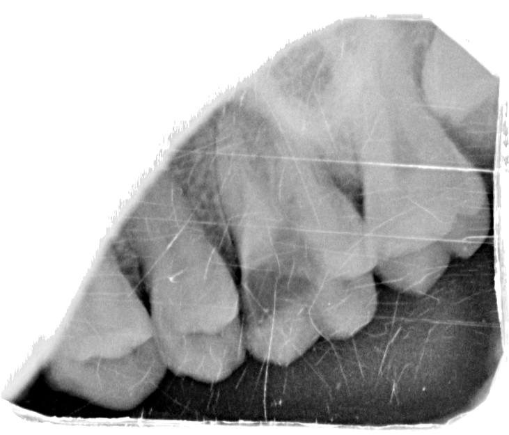 x`ray type Classification Dataset by begad