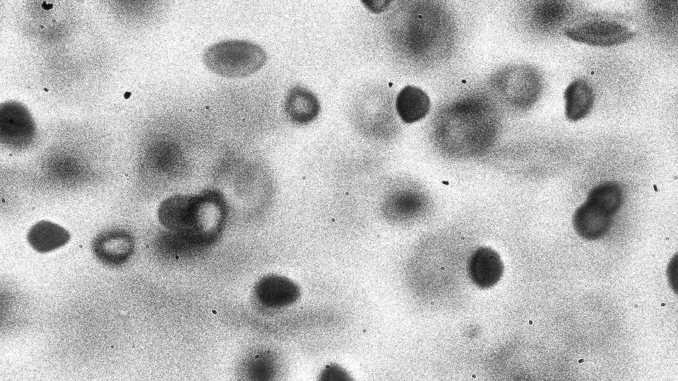 Detecting Sickle Cells in Blood Object Detection Dataset and Pre ...