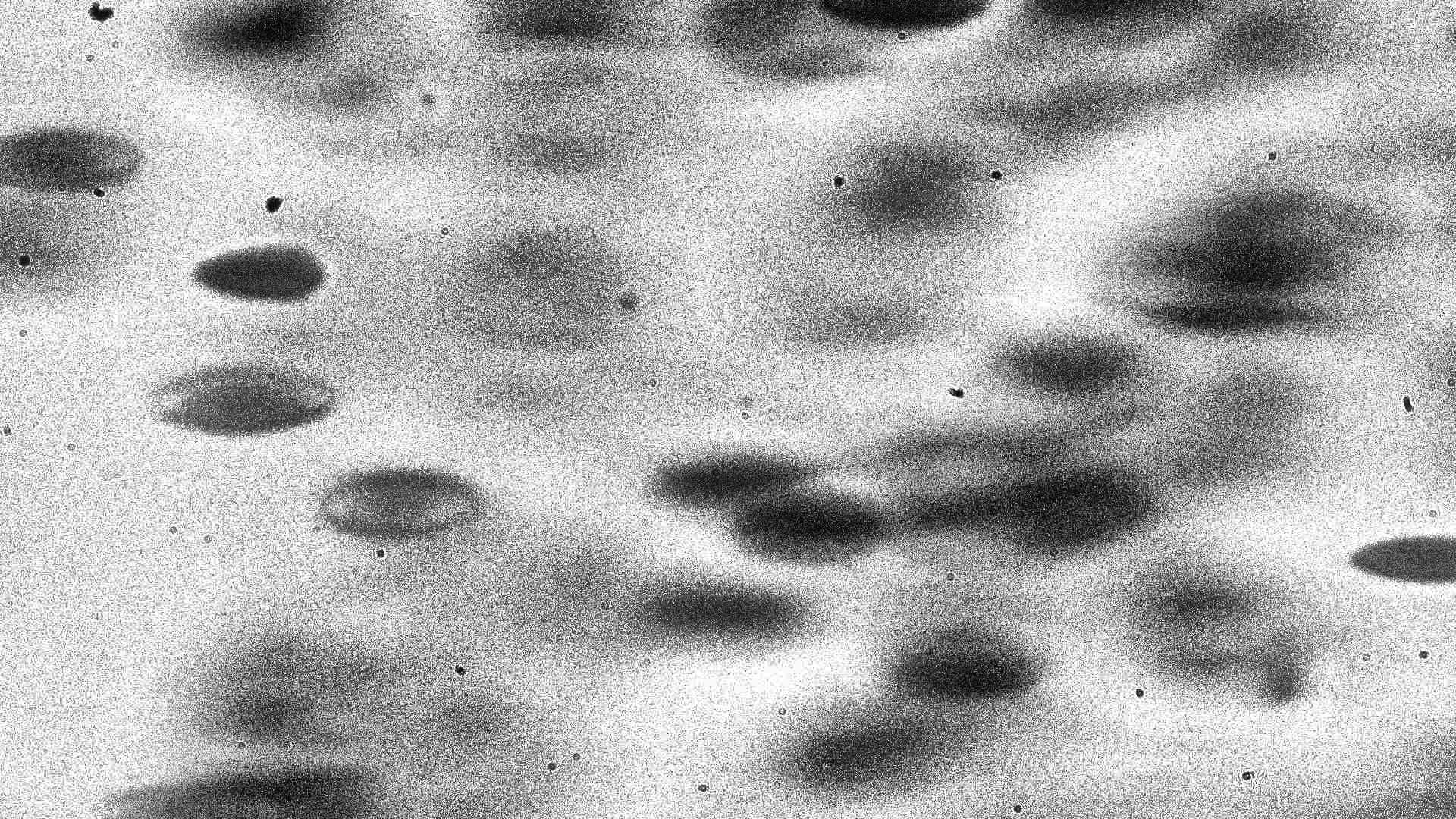 scc Object Detection Model by sickle cell classifications