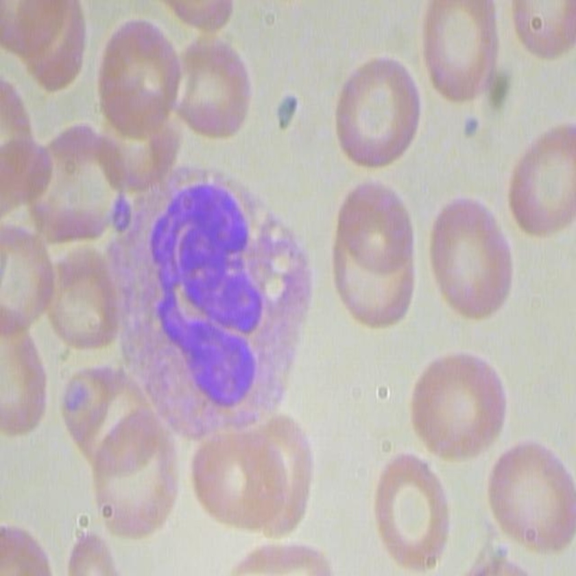 checkfinal Object Detection Dataset by WBCs