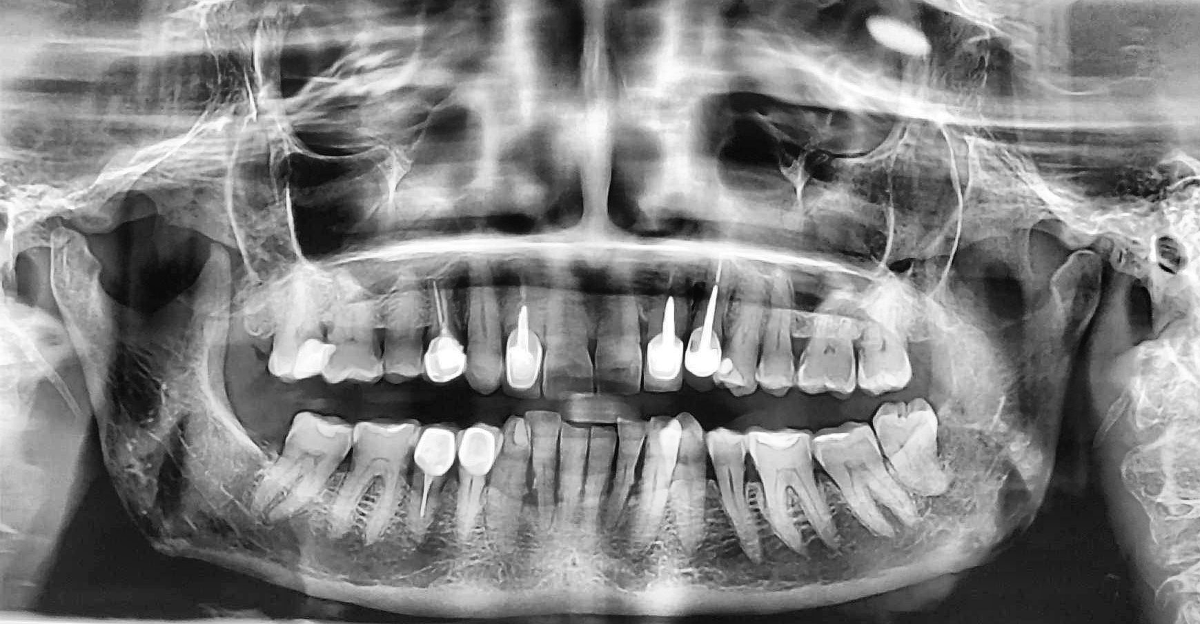 tst_opg Object Detection Dataset by AIUB