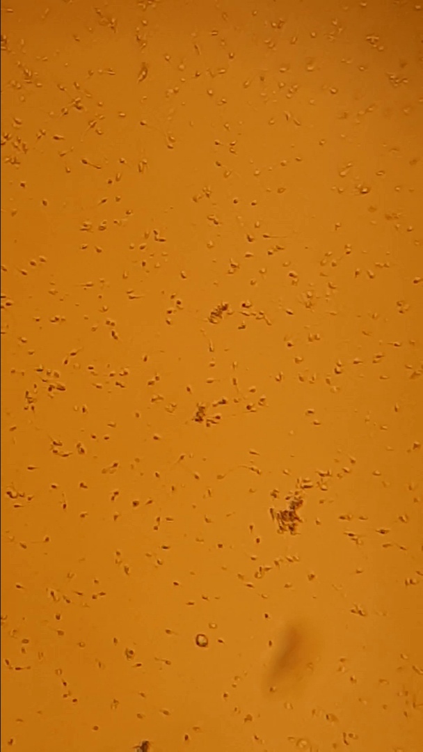 Sperm Segmentation M1 Instance Segmentation Dataset V1 2023 10 07 642am By Projects