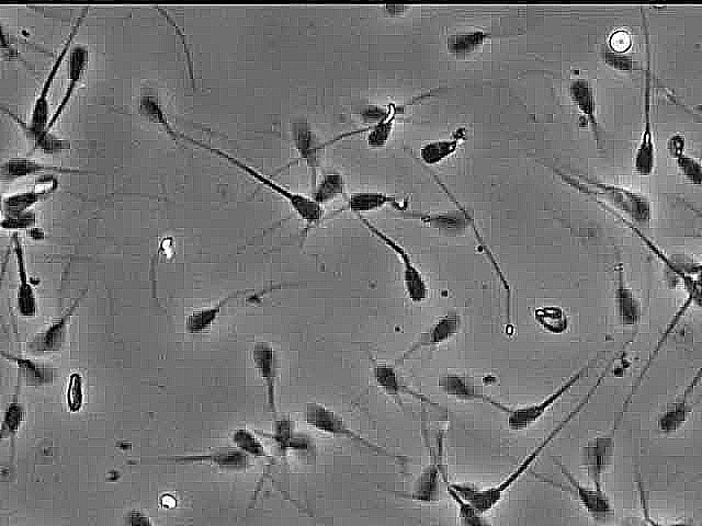 Sperm_Bull Instance Segmentation Dataset by projects