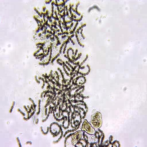 Bacteria Detection Roboflow Universe