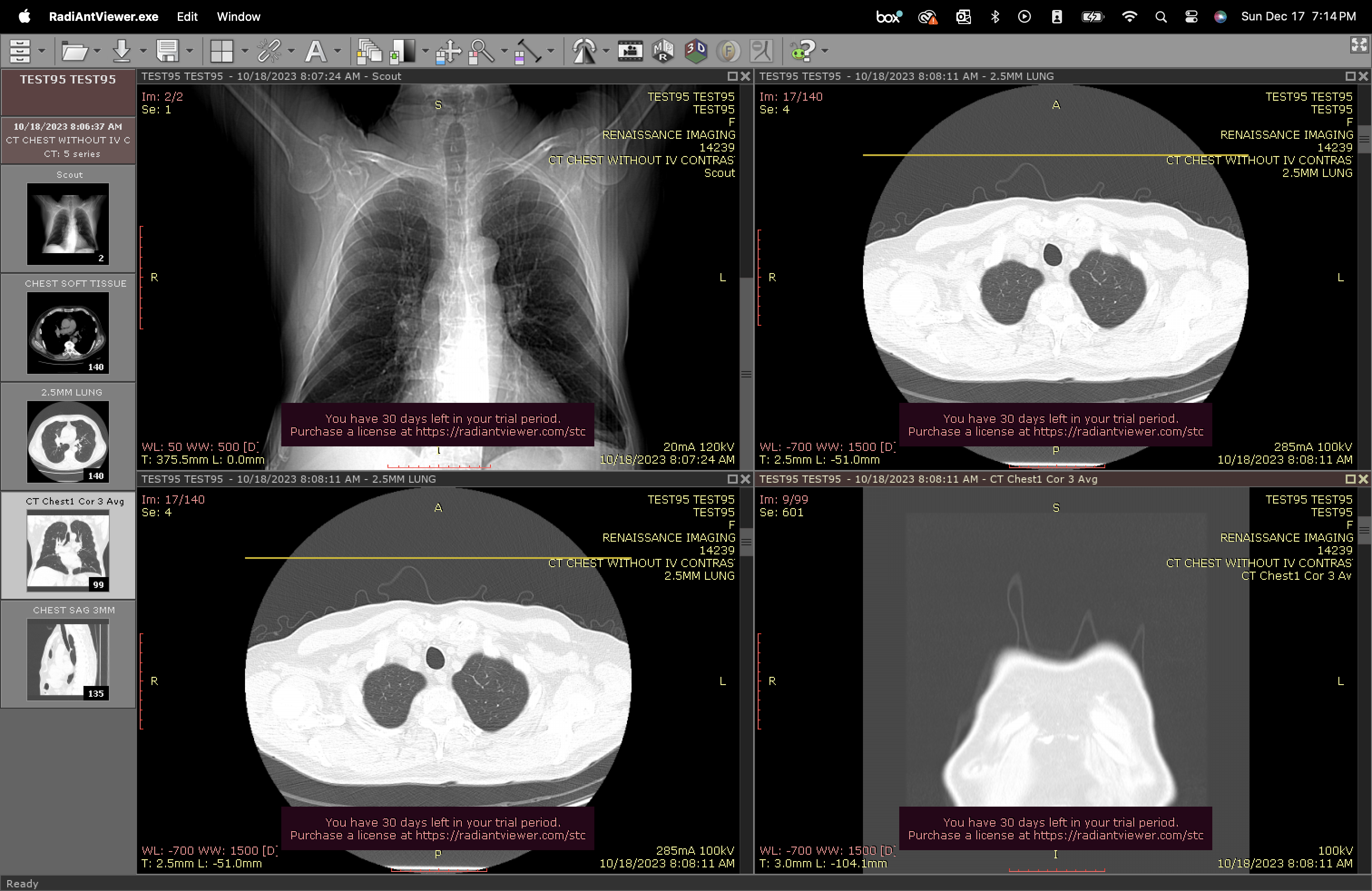 Dicom Samples Object Detection Dataset And Pre Trained Model By Ilibriumrema