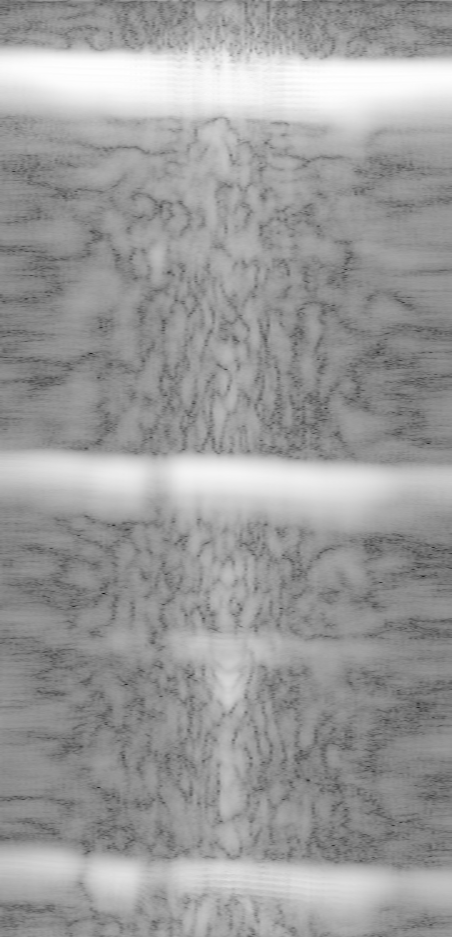 ultrasound-defect-outlier-detect Instance Segmentation Dataset by SW
