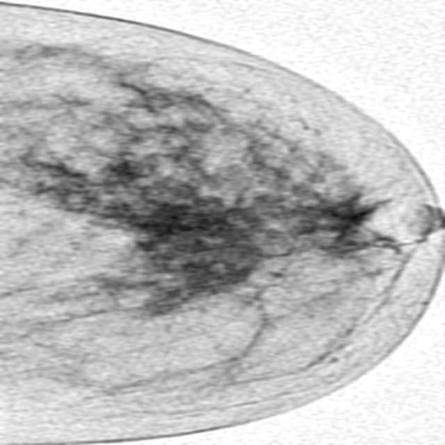 ana_model Object Detection Dataset and Pre-Trained Model by mehmet
