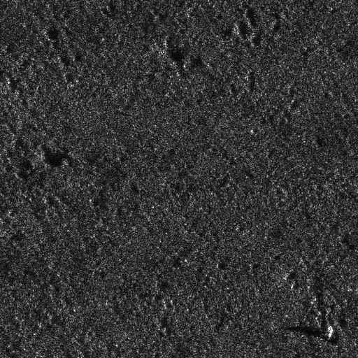 Sonar 00 Object Detection Dataset By Sonar