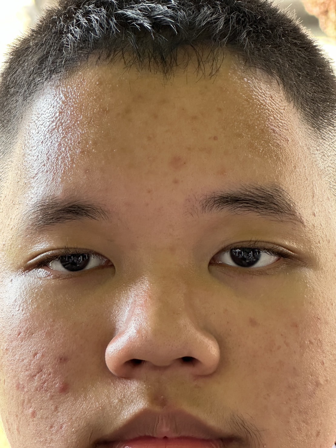 eye Object Detection Model by eye