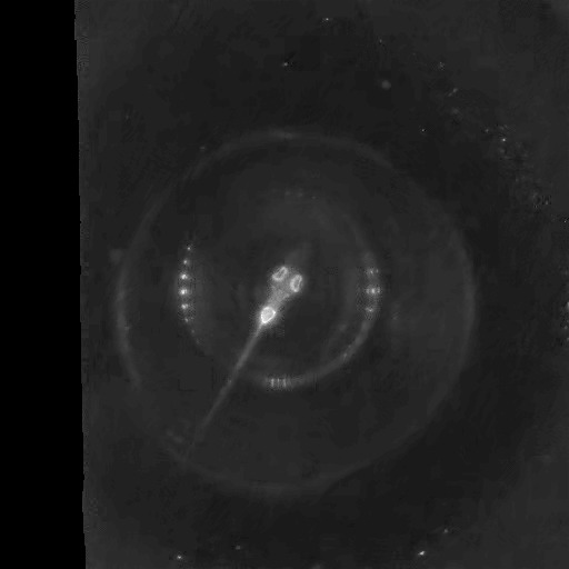 Para Log - Roboflow Universe