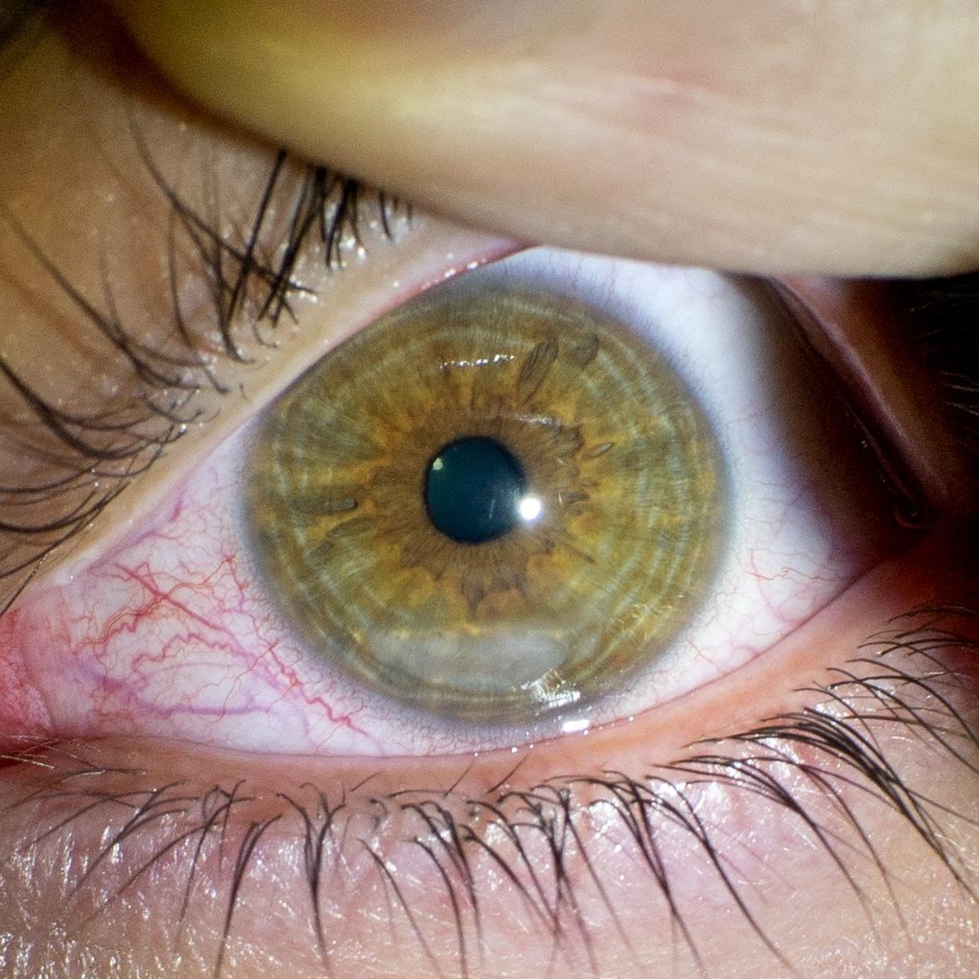 iris-eye Object Detection Dataset by ProjekAkhir