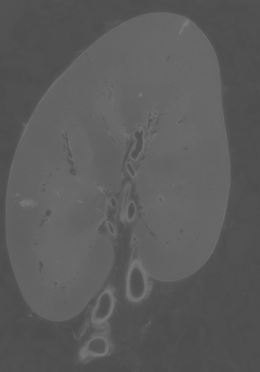 class:renal-vessel | Roboflow Universe Search class:renal-vessel | Roboflow Universe Search