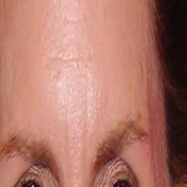 Skin Dataset Classification Dataset And Pre Trained Model By Yolov5