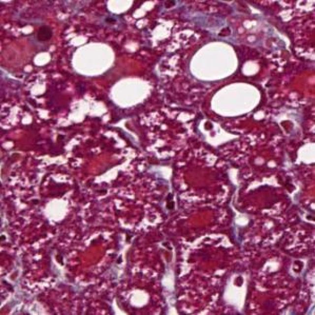 liver Object Detection Dataset by liver