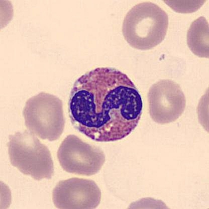 wbc Object Detection Dataset by trst1