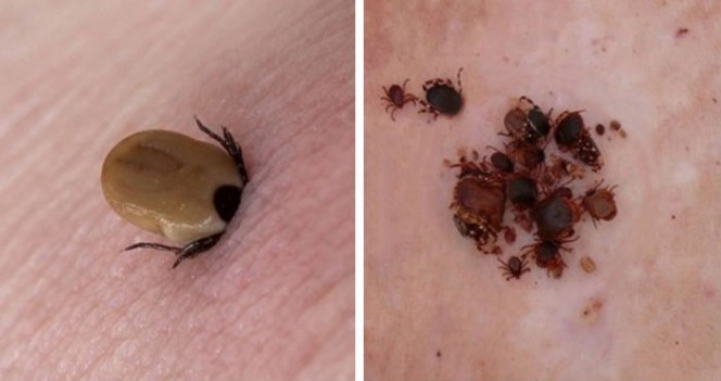 Tick Detection Object Detection Dataset by jhunt22@ross.org