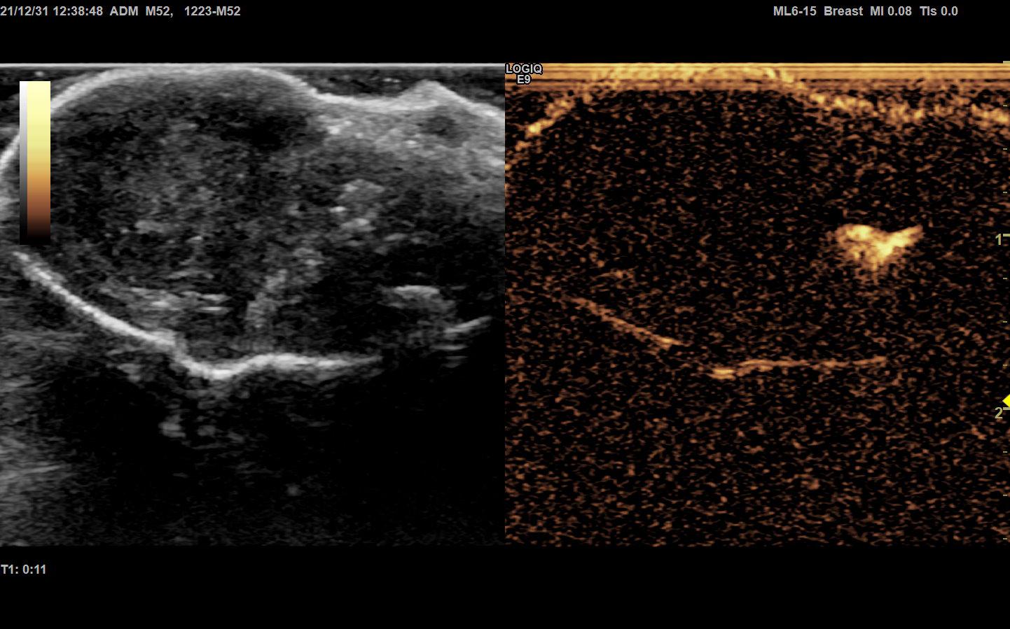 CEUS Object Detection Dataset by Xiamen university