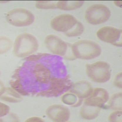 blood cell Object Detection Model by blood cell